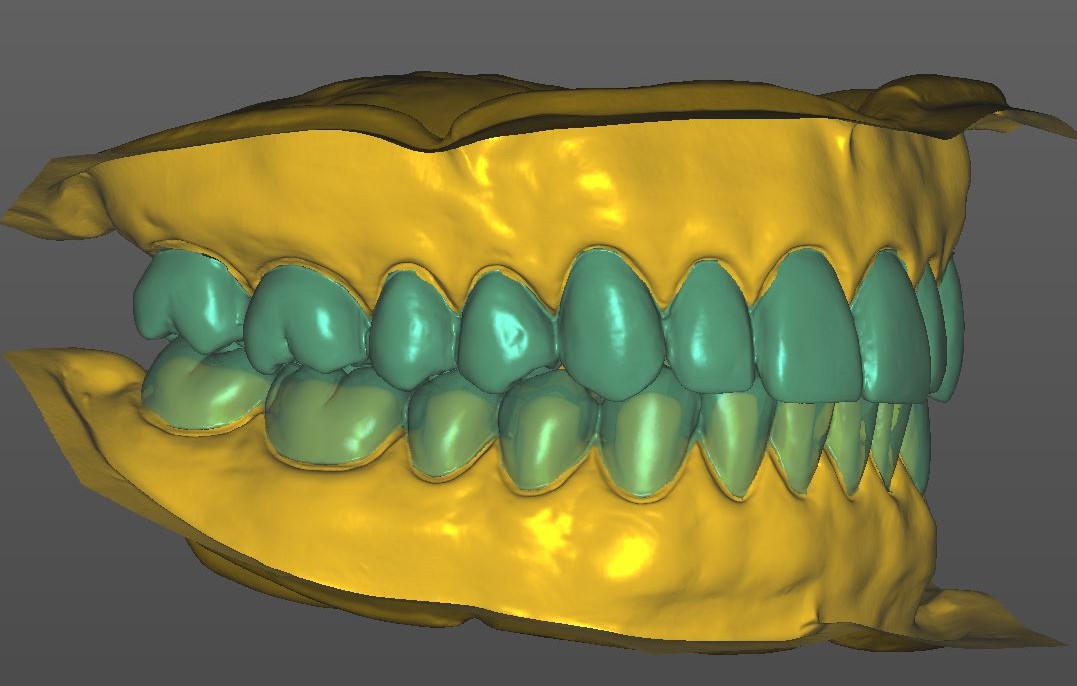 Waxup of full arc - DigitalWaxup.com